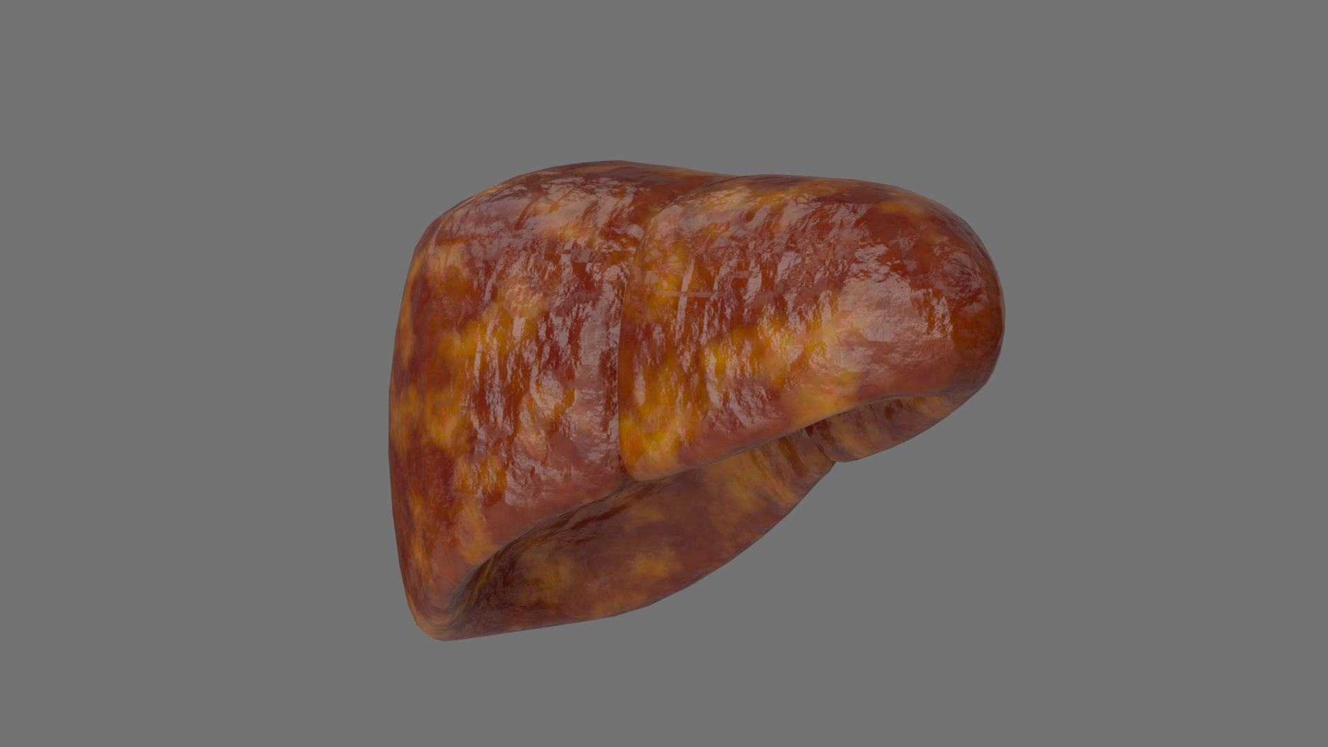 Hepatic Steatosis - Liver Fat 3D model | CGTrader