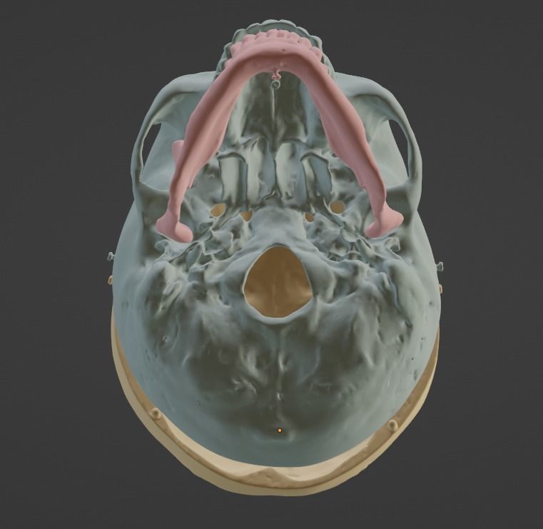 3D Model of Skull with Skull Cap and Mandible 3D model | CGTrader