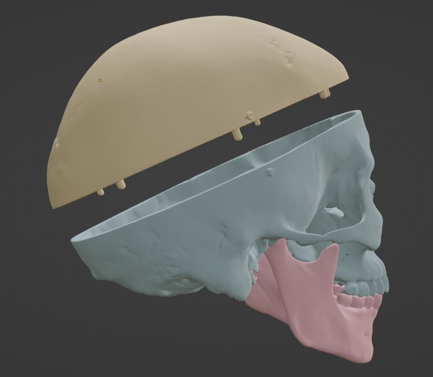 3D Model of Skull with Skull Cap and Mandible 3D model | CGTrader