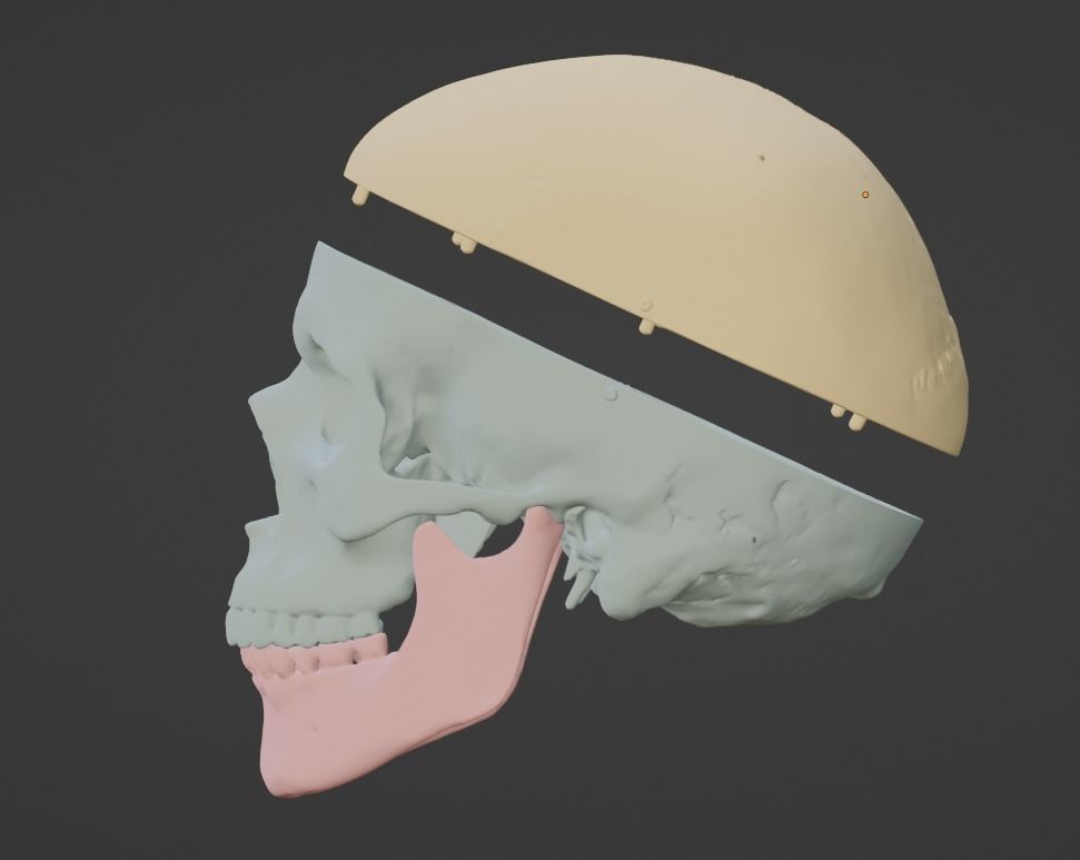 3D Model of Skull with Skull Cap and Mandible 3D model | CGTrader