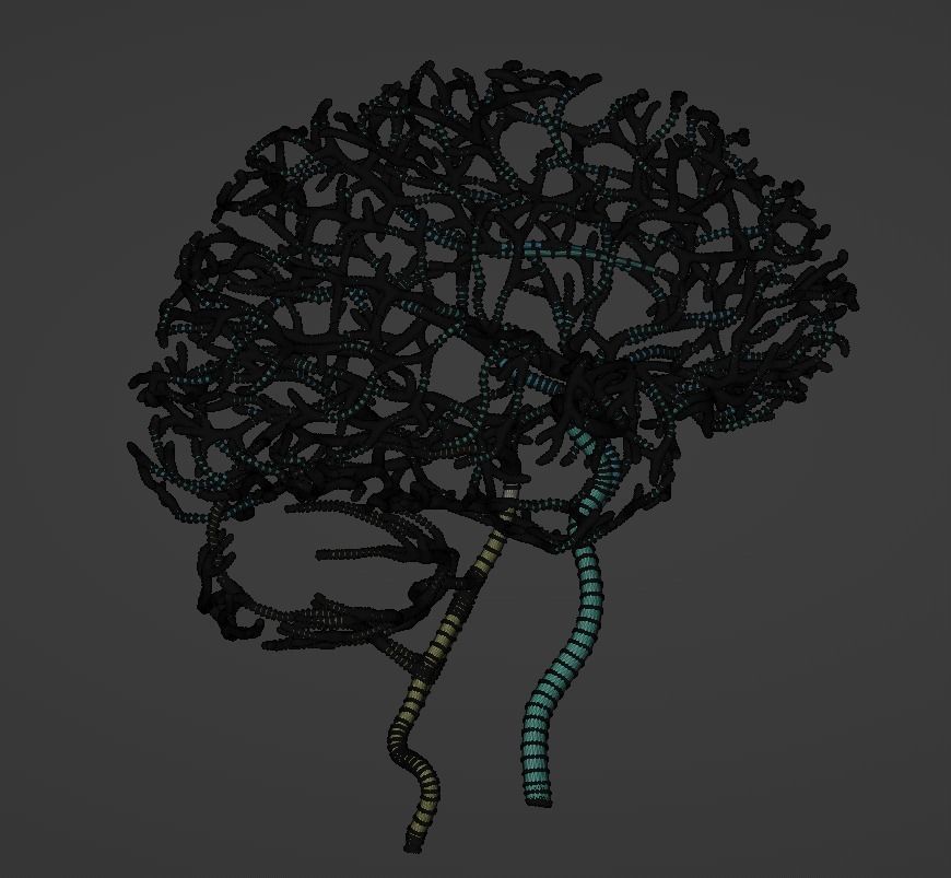 3D Model of Brain and Aneurysm 3D model | CGTrader