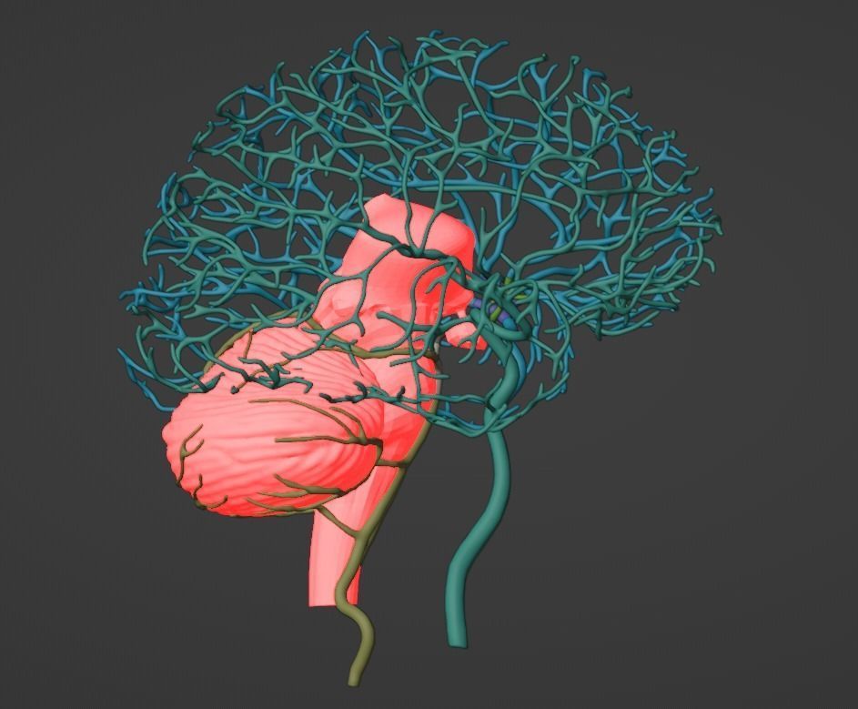 3D Model of Brain and Aneurysm 3D model | CGTrader