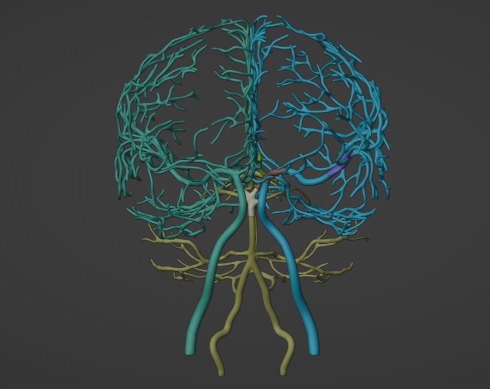3D Model of Brain and Aneurysm 3D model | CGTrader