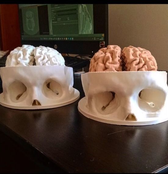 Skull and brain 3D model 3D printable | CGTrader