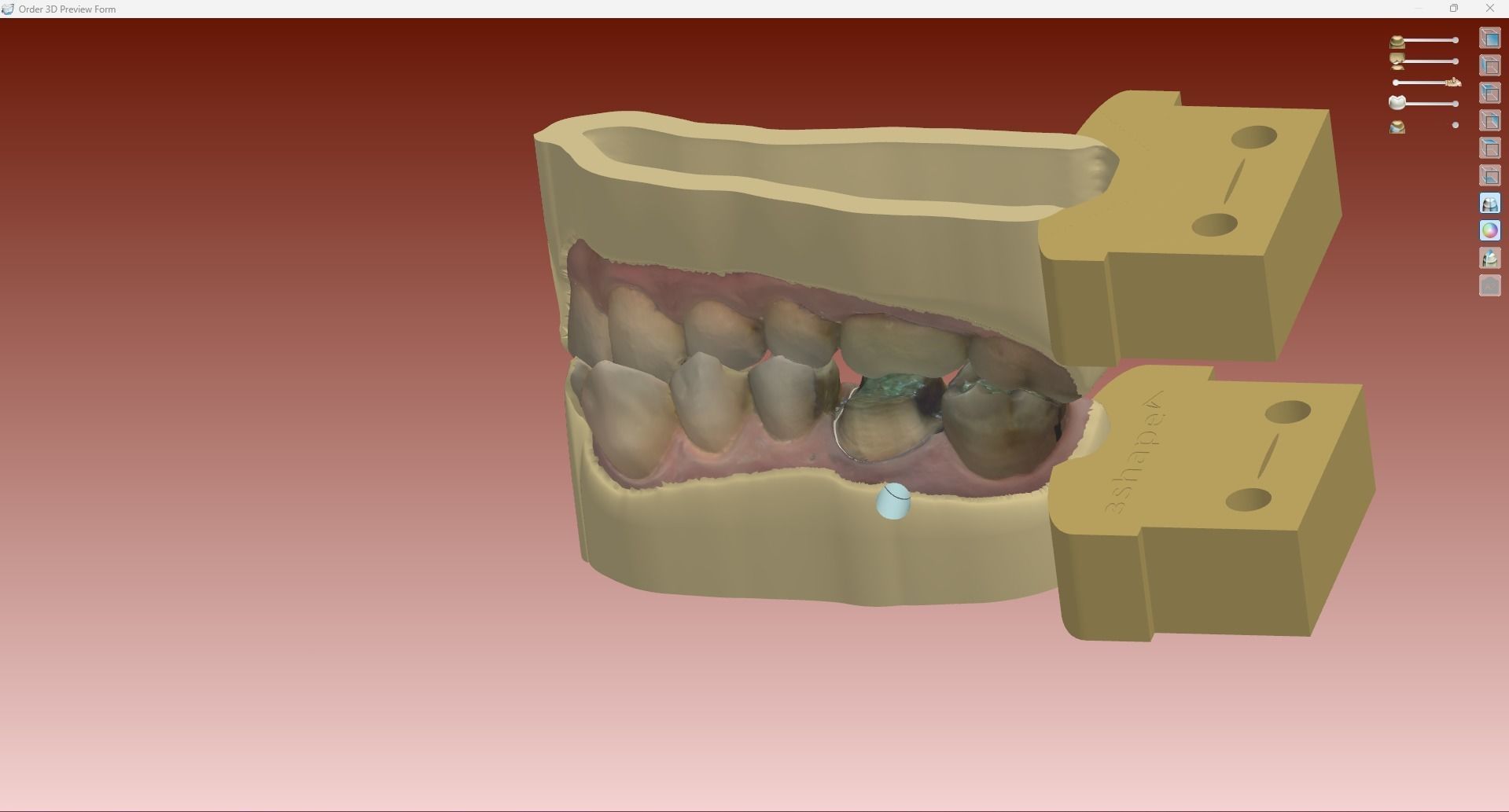 Digital Quadrant Model with iTero Articulator Interfaces 3D model 3D ...