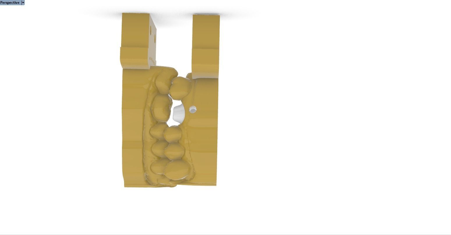 Digital Quadrant Model with iTero Articulator Interfaces 3D model 3D ...