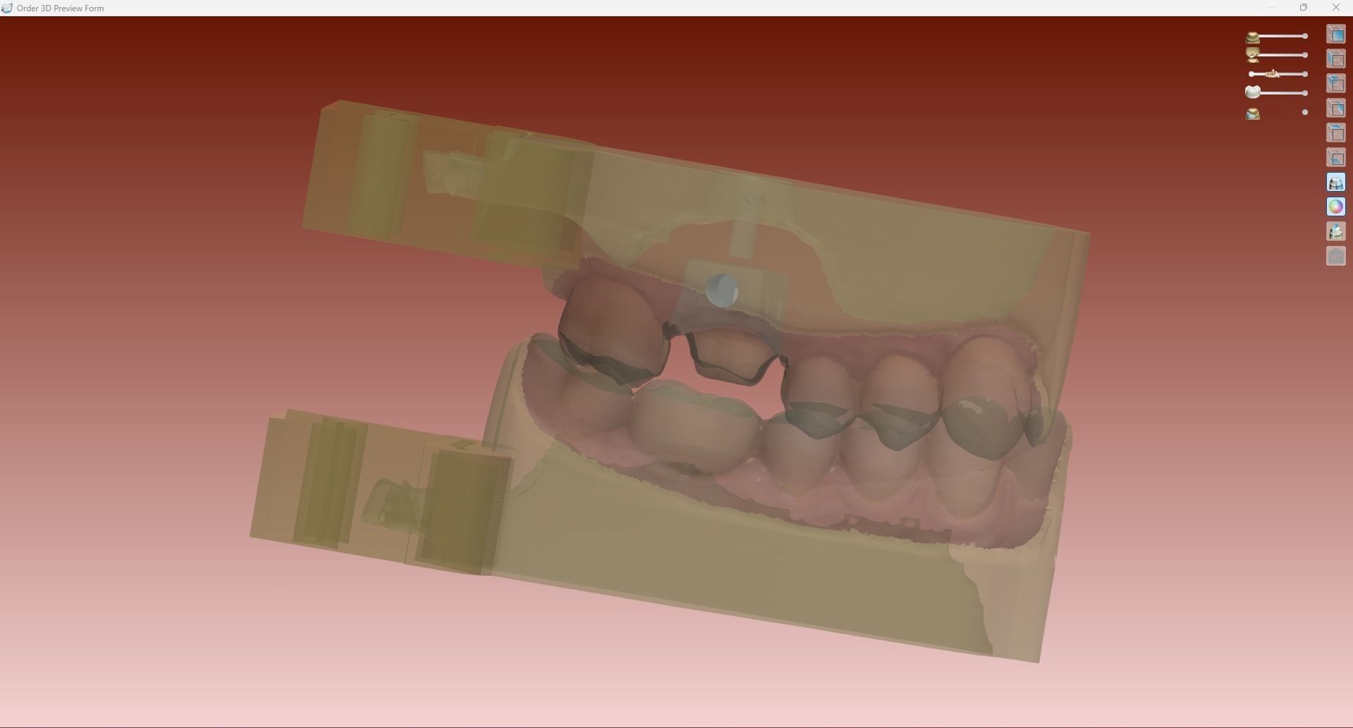 Digital Quadrant Model with iTero Articulator Interfaces 3D model 3D ...