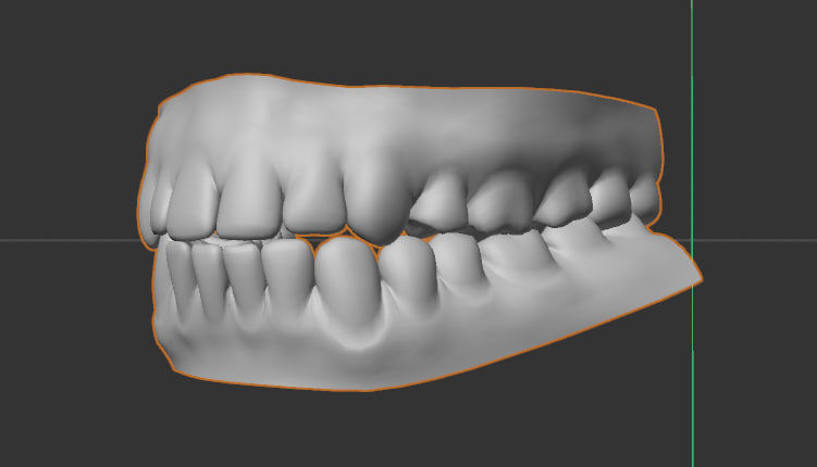 Teeth free 3D model | CGTrader