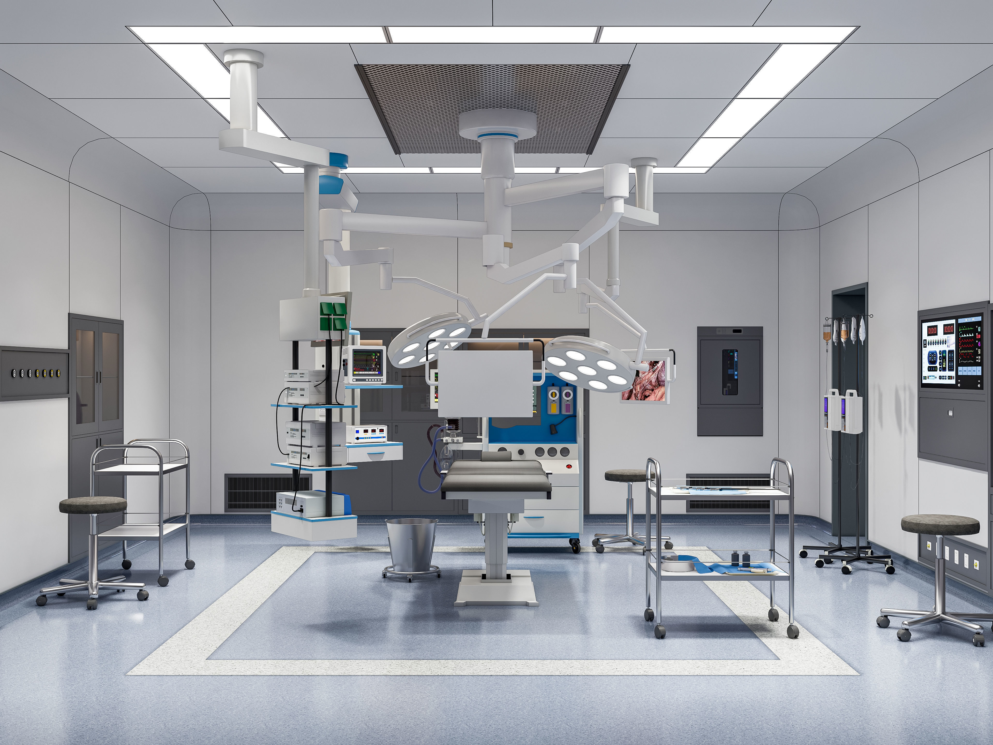 Hospital Laparoscopic operating room 3D model | CGTrader