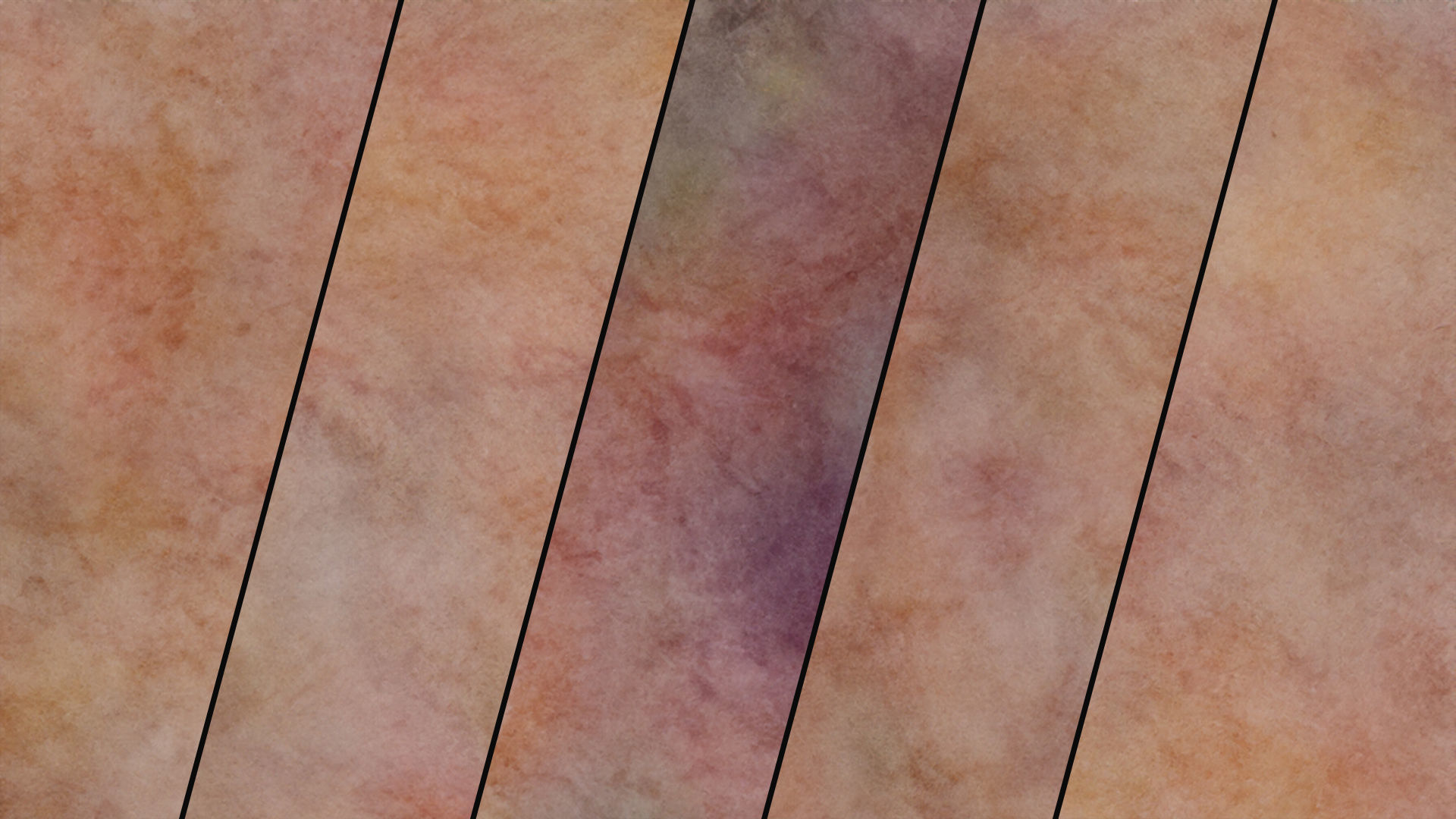 3D model Premium Human Skin Pack High-Quality Decal Alpha Overlay Maps ...