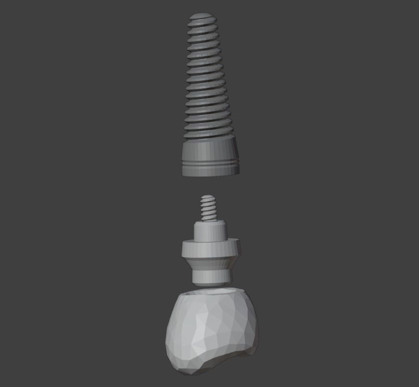 3D Model of Dental Implant 3D model | CGTrader