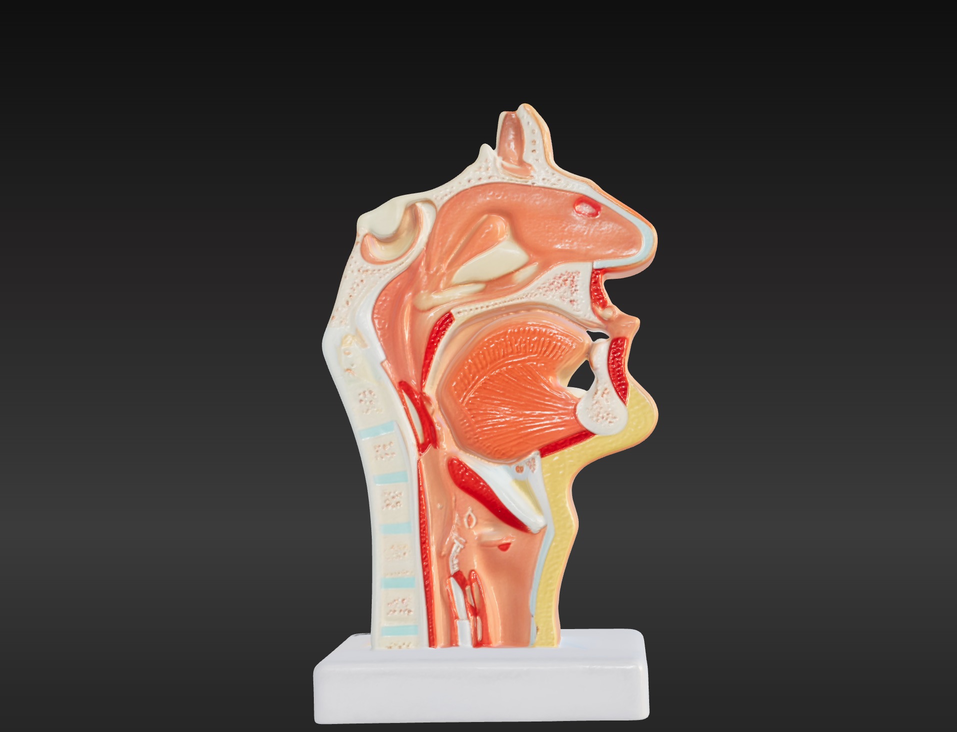 3D Model of Larynx and Pharynx Disorders 3D model 3D printable | CGTrader