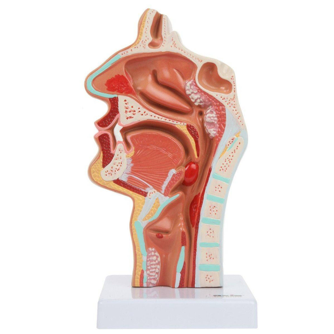 3D Model of Larynx and Pharynx Disorders 3D model 3D printable | CGTrader