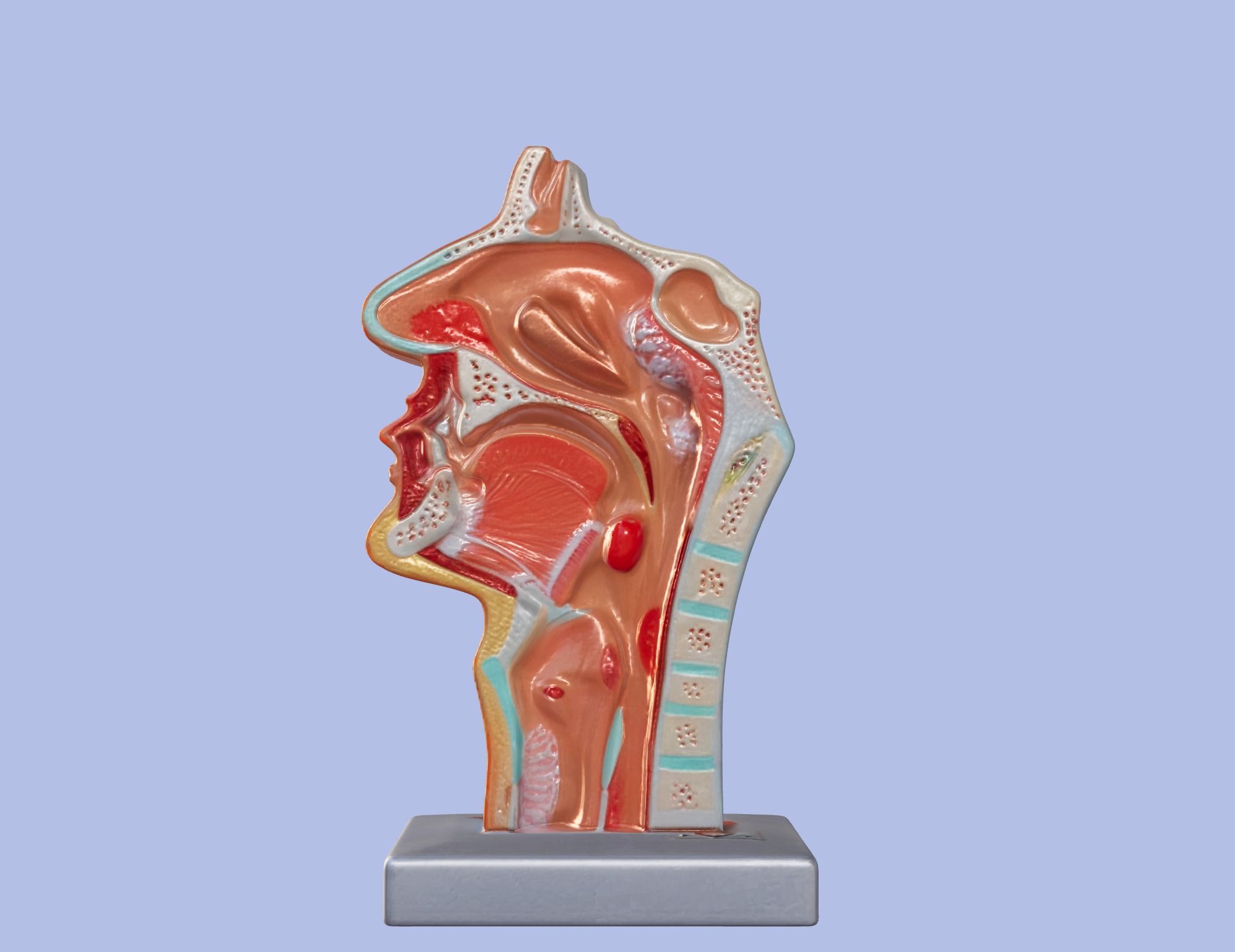3D Model of Larynx and Pharynx Disorders 3D model 3D printable | CGTrader