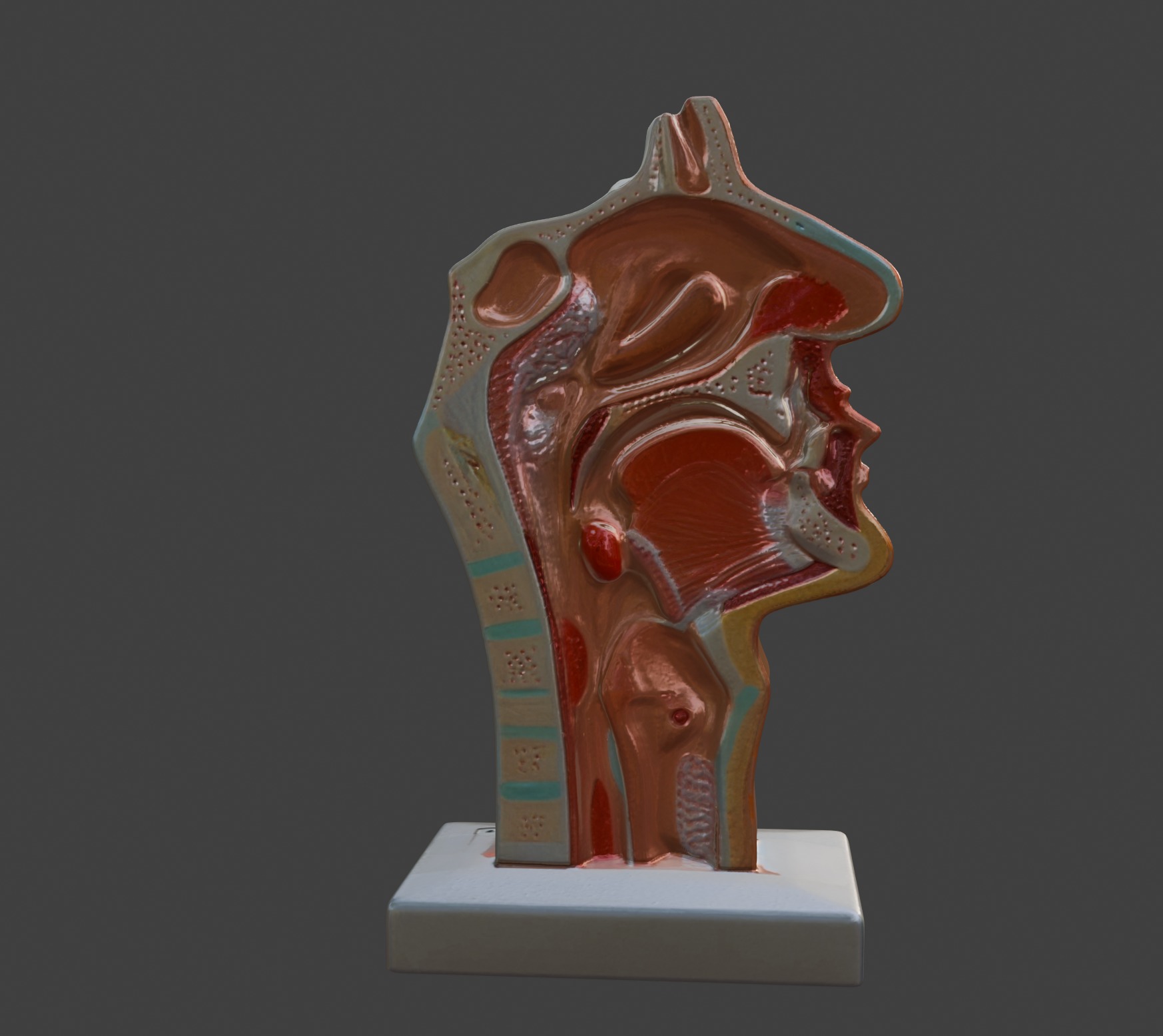 3D Model of Larynx and Pharynx Disorders 3D model 3D printable | CGTrader