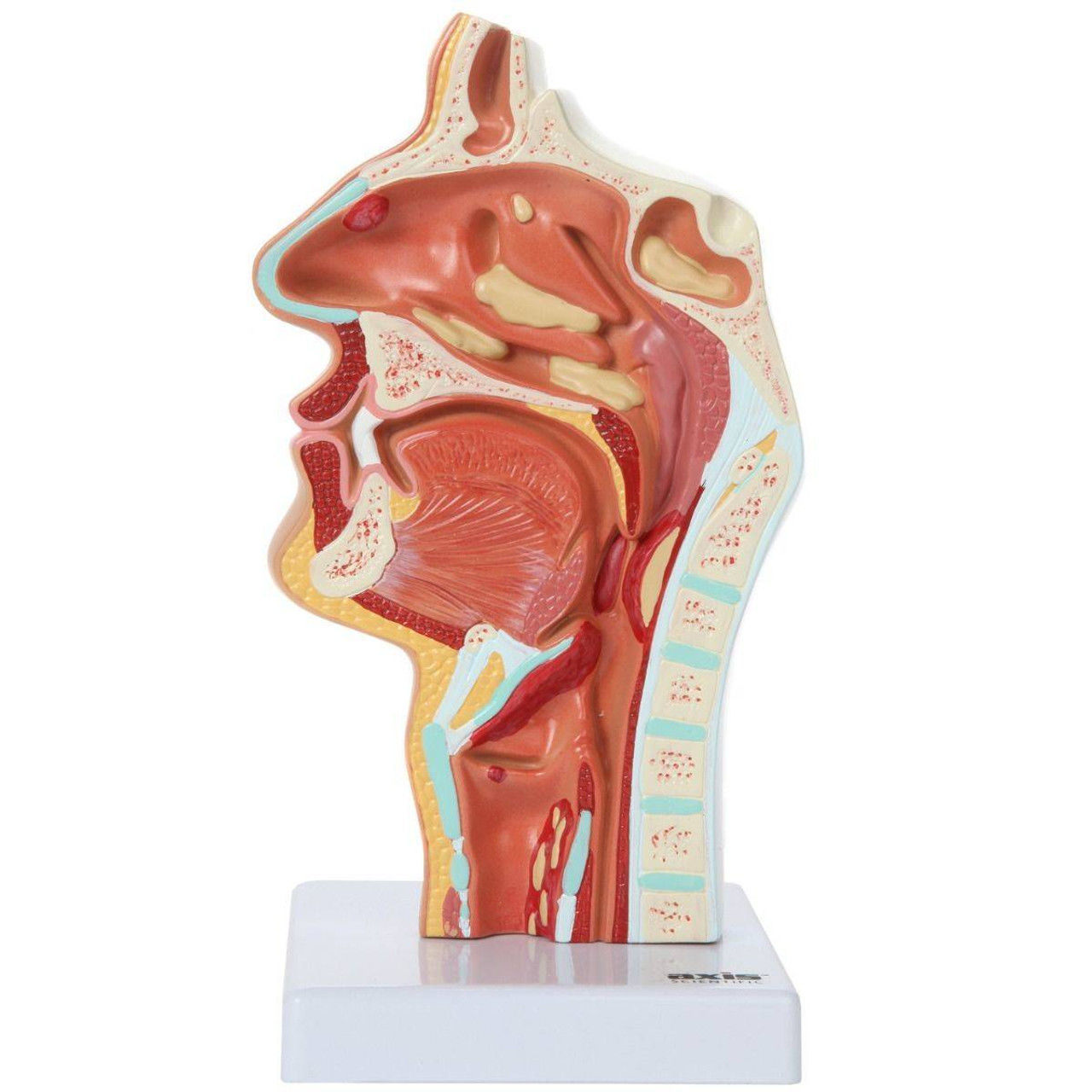 3D Model of Larynx and Pharynx Disorders 3D model 3D printable | CGTrader