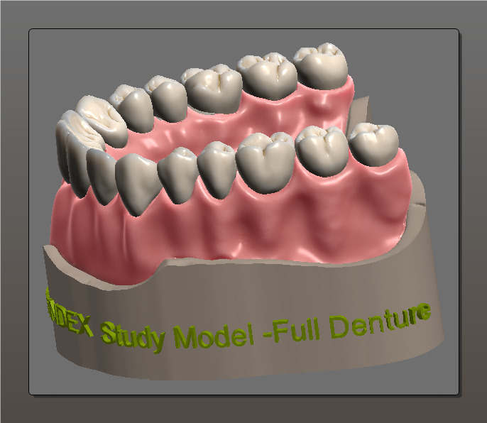 Example of an Adult dental Model free 3D model 3D printable | CGTrader