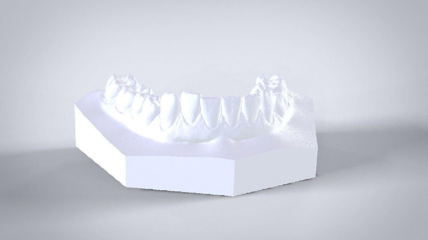 Digital Spear Deprogrammer Splint 3D model 3D printable | CGTrader