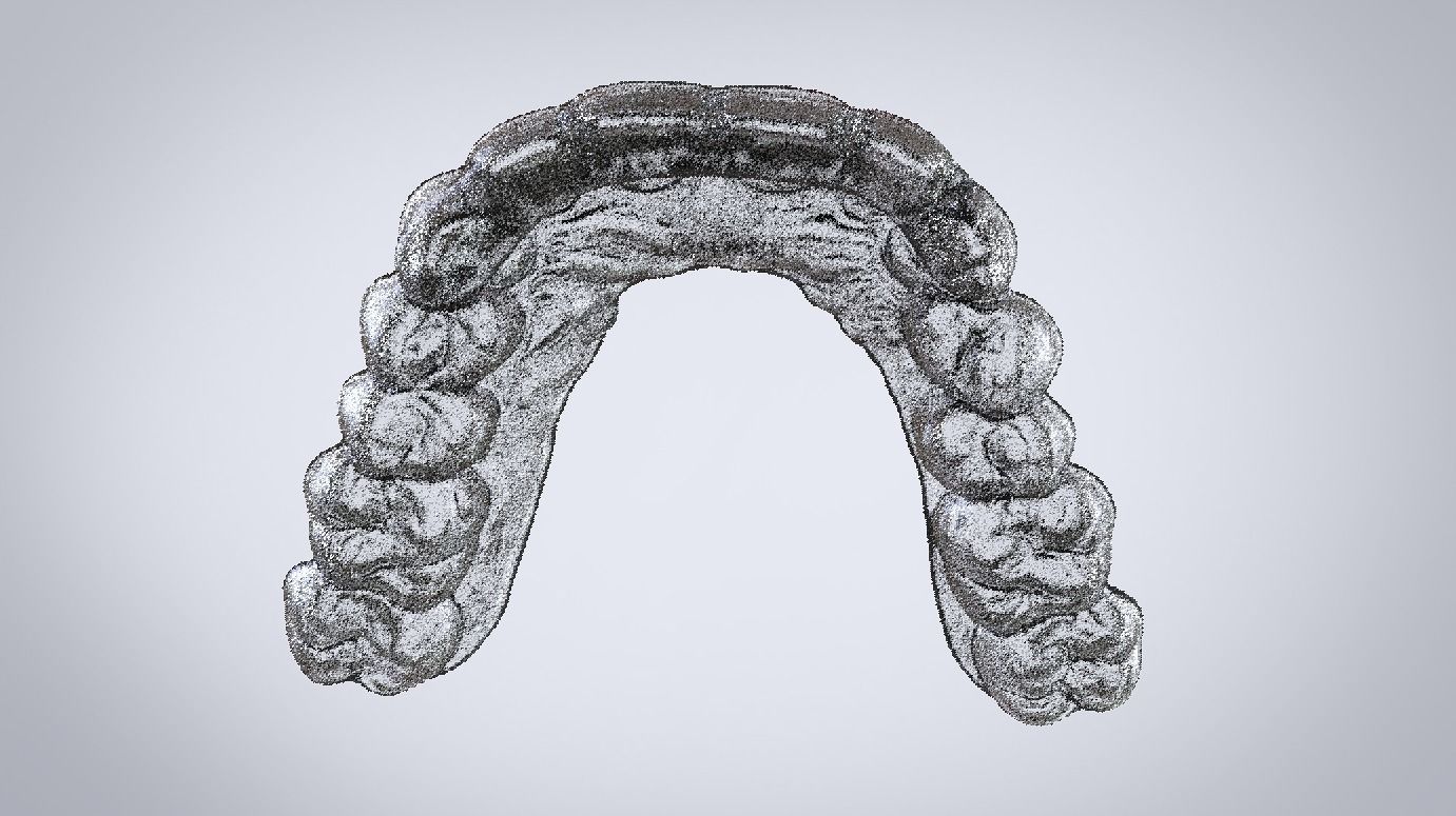 Digital Spear Deprogrammer Splint 3D model 3D printable | CGTrader