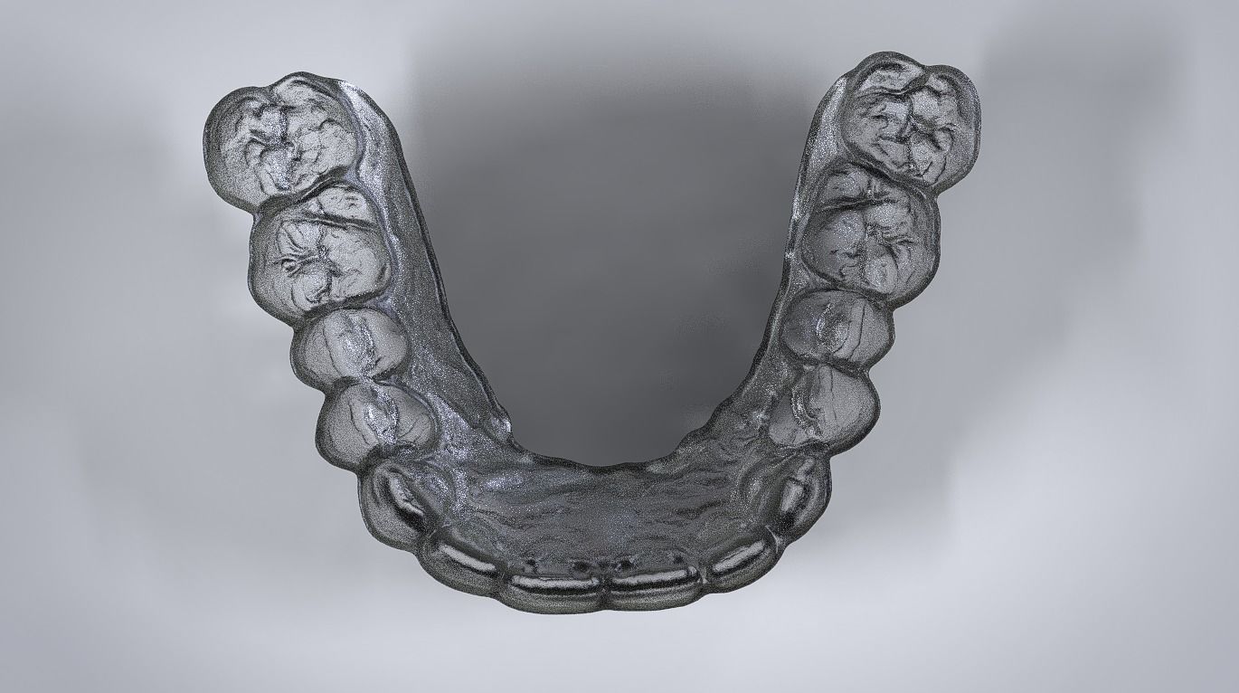 Digital Spear Deprogrammer Splint 3D model 3D printable | CGTrader