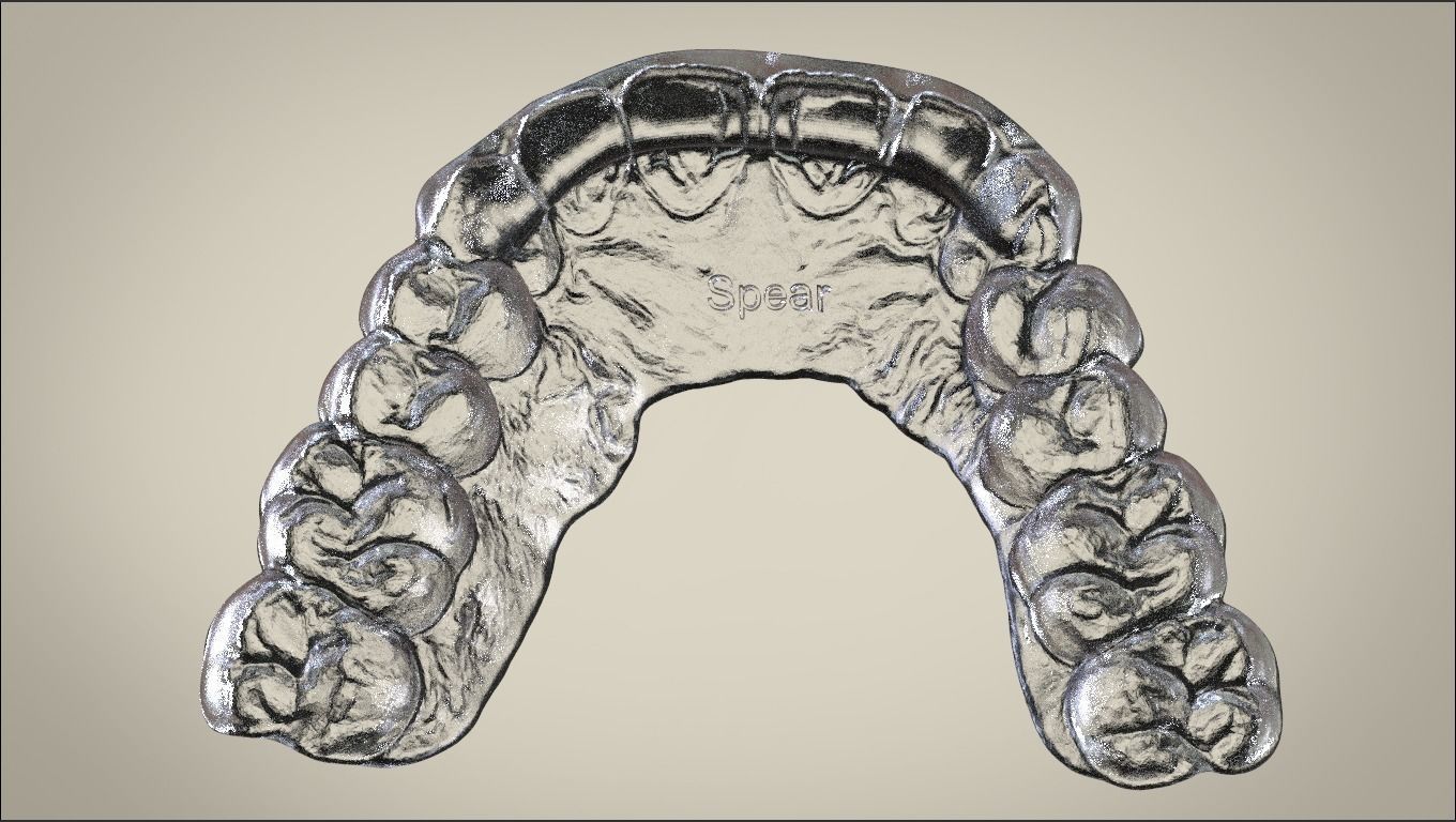 Digital Spear Deprogrammer Splint 3D model 3D printable | CGTrader