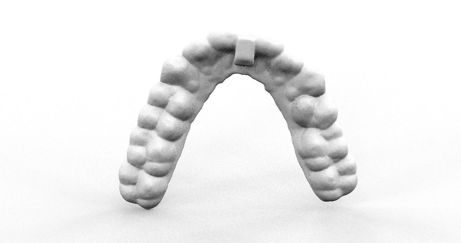 Digital Hard Nightguard Splint 3D model 3D printable | CGTrader