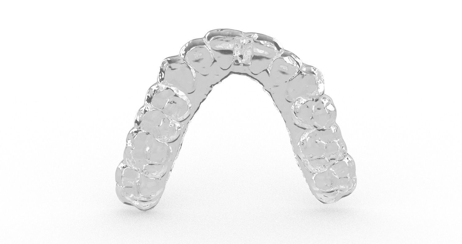Digital Hard Nightguard Splint 3D model 3D printable | CGTrader