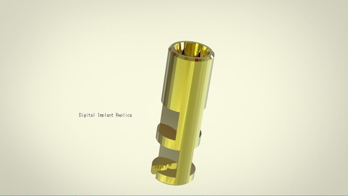 Digital Dental Implant Model with Positioning Guide 3D model 3D ...