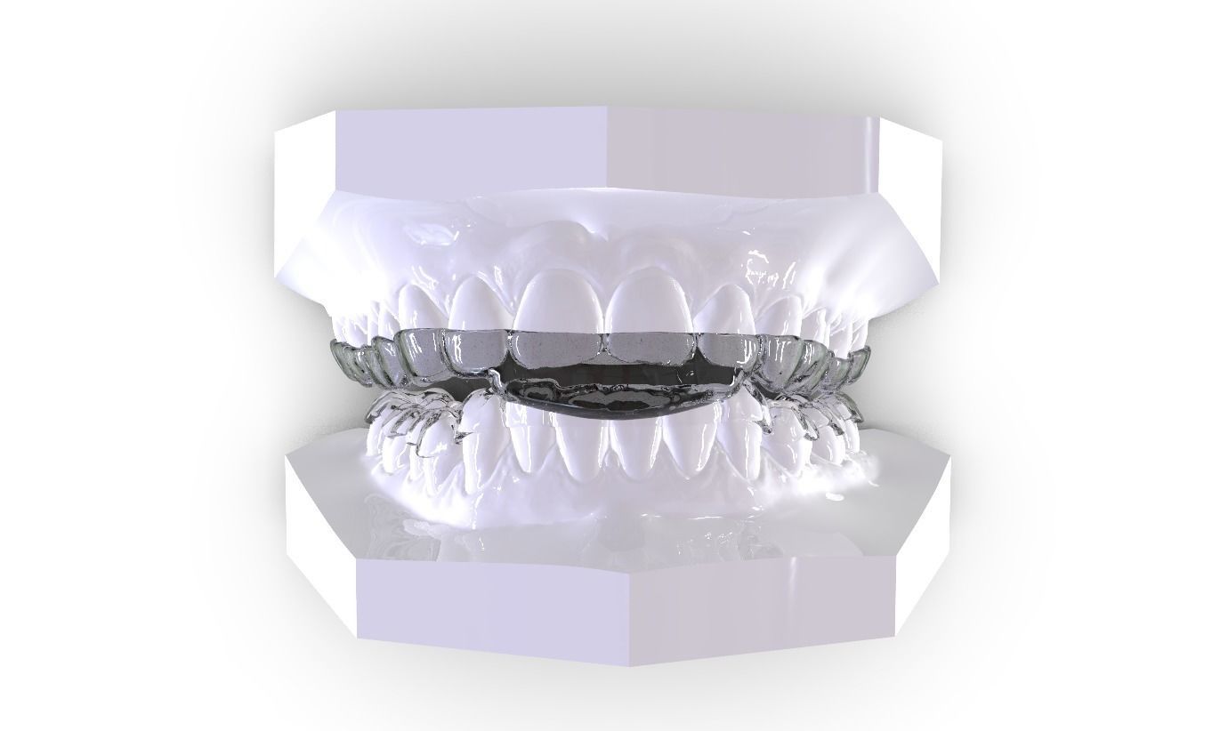 Digital Dental B Splints 3D model 3D printable | CGTrader