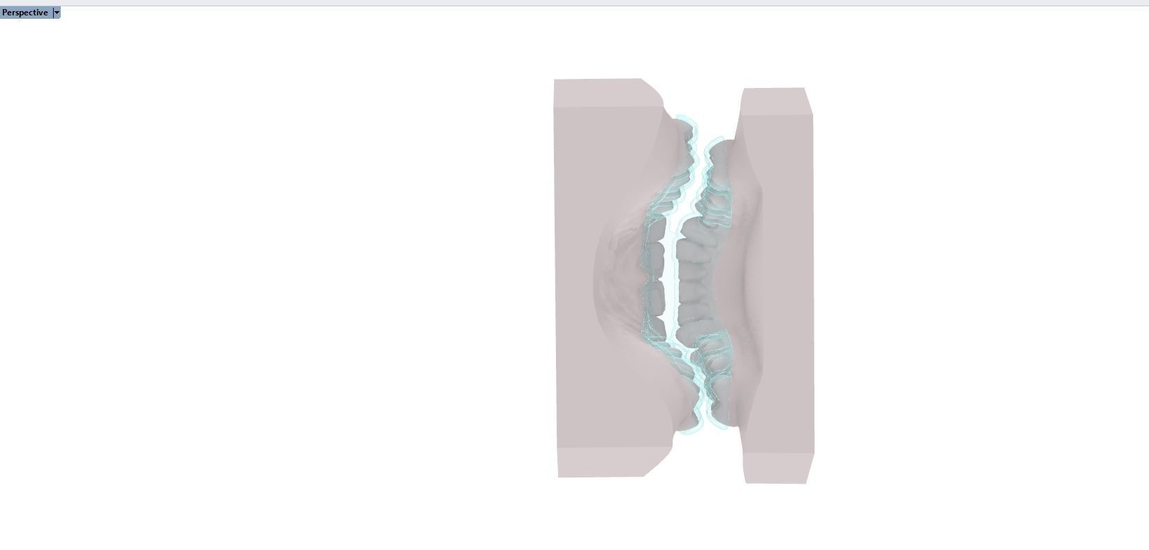 Digital Dental B Splints 3D model 3D printable | CGTrader