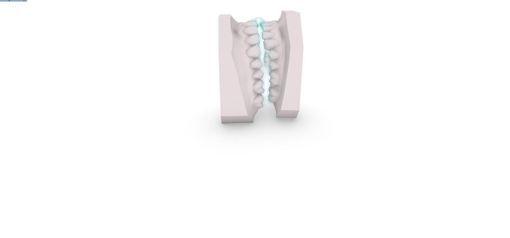Digital Dental B Splints 3D model 3D printable | CGTrader
