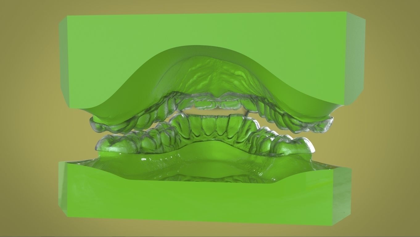 Digital Dental B Splints 3D model 3D printable | CGTrader