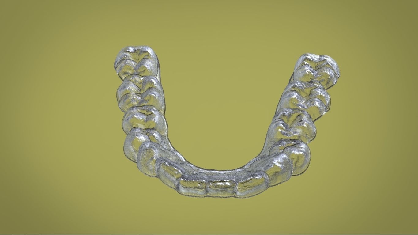 Digital Dental B Splints 3D model 3D printable | CGTrader