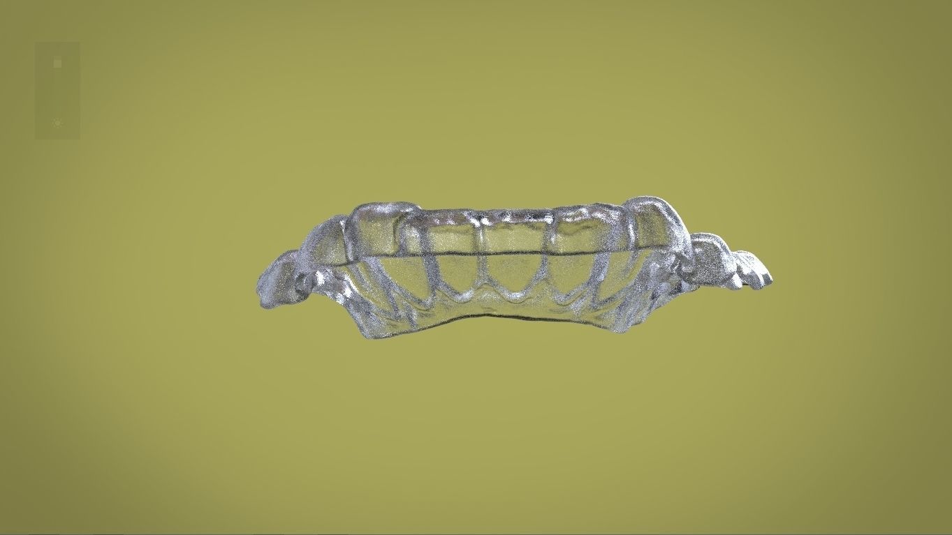 Digital Dental B Splints 3D model 3D printable | CGTrader