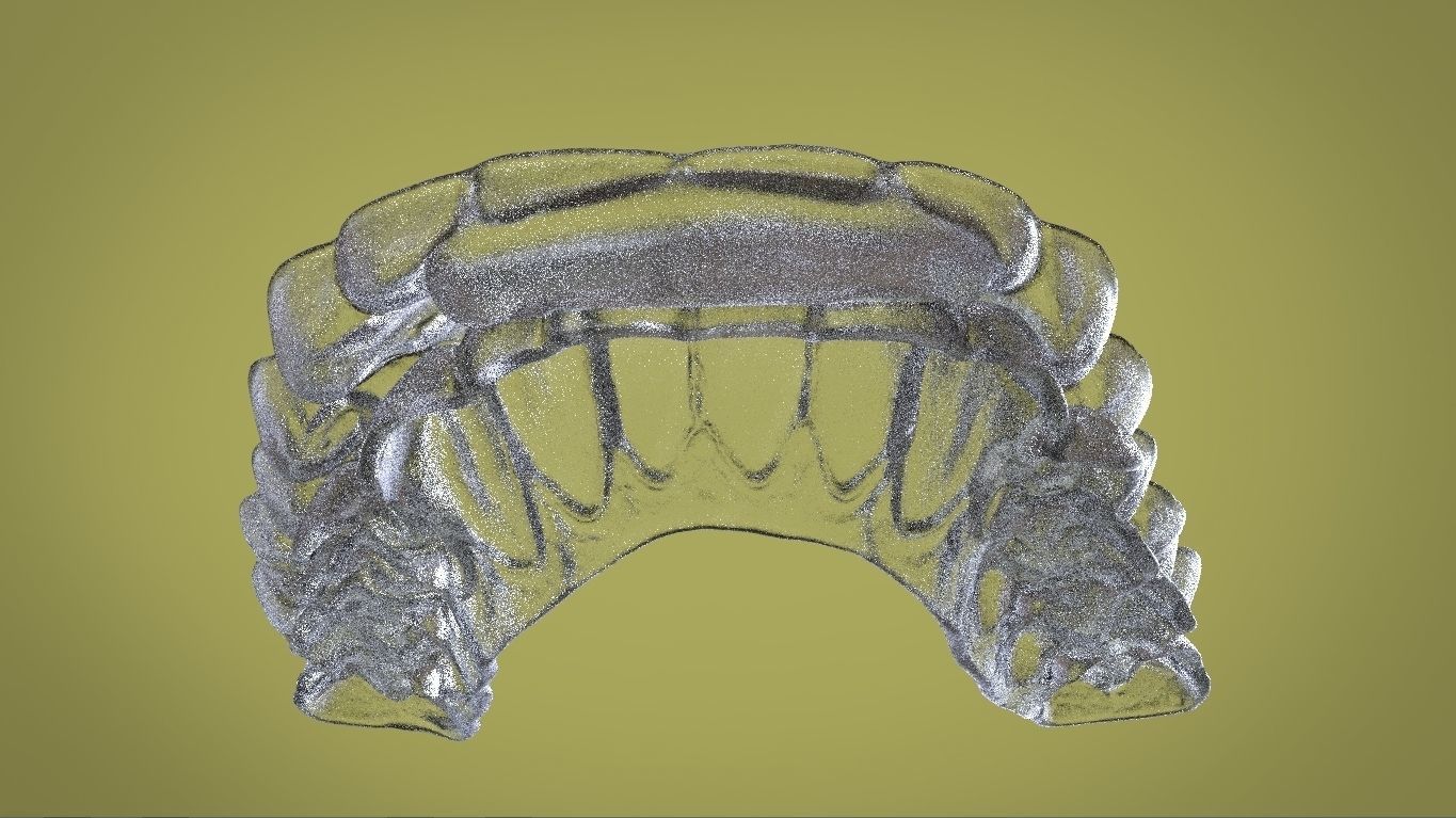 Digital Dental B Splints 3D model 3D printable | CGTrader