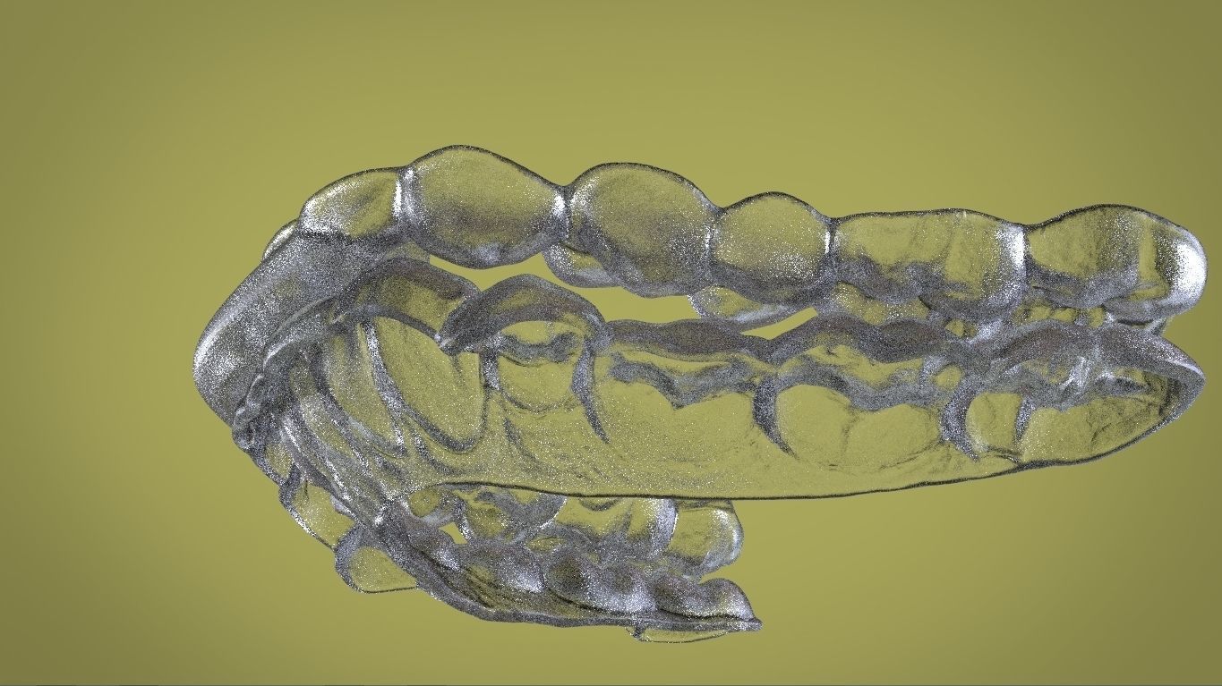 Digital Dental B Splints 3D model 3D printable | CGTrader