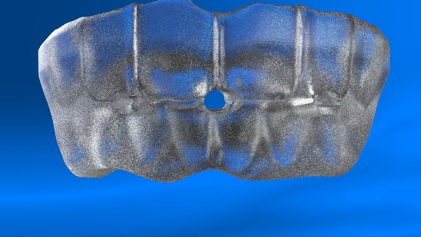 Digital Ortho Tooth Positioner 3D model 3D printable | CGTrader