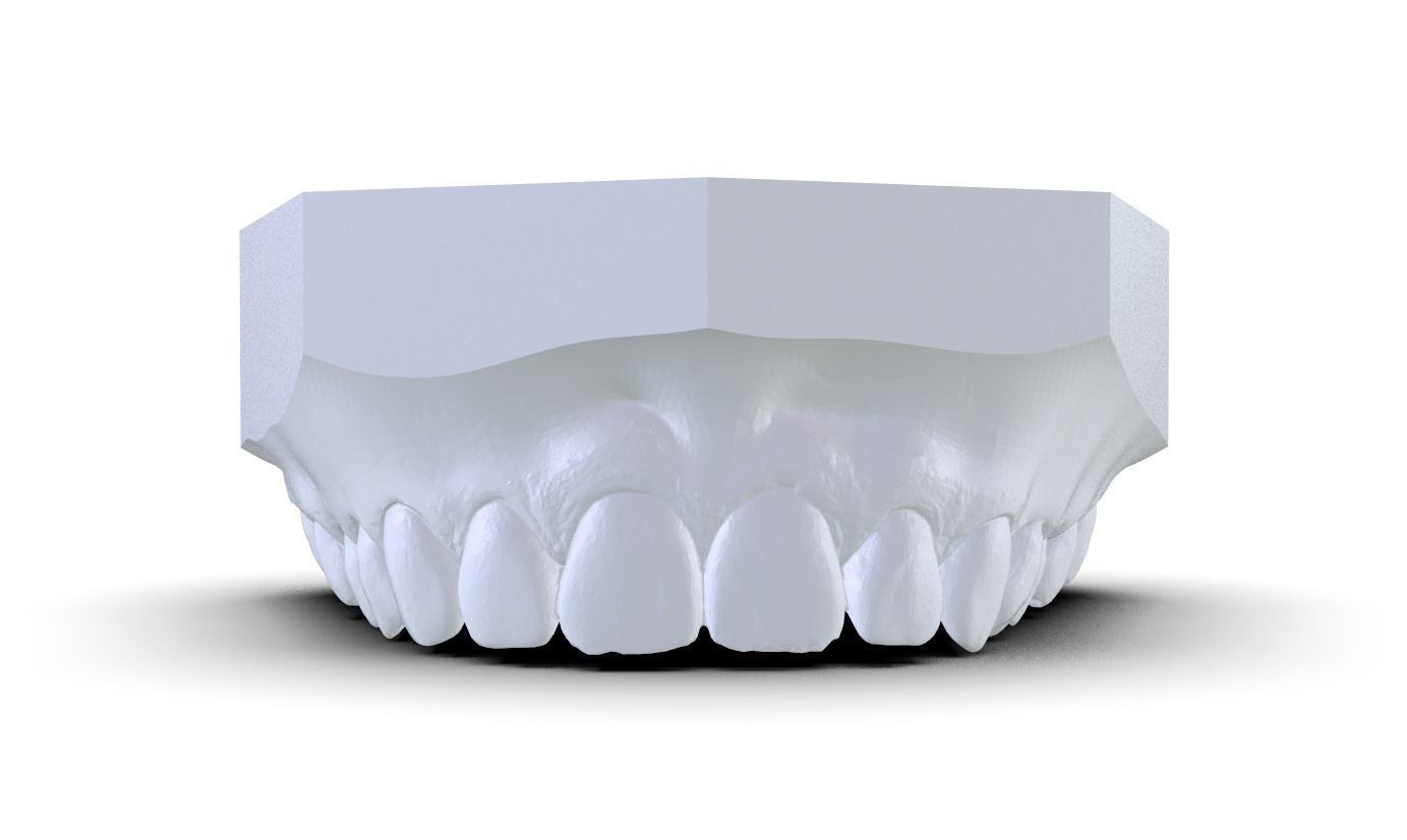 Digital Ortho Tooth Positioner 3D model 3D printable | CGTrader