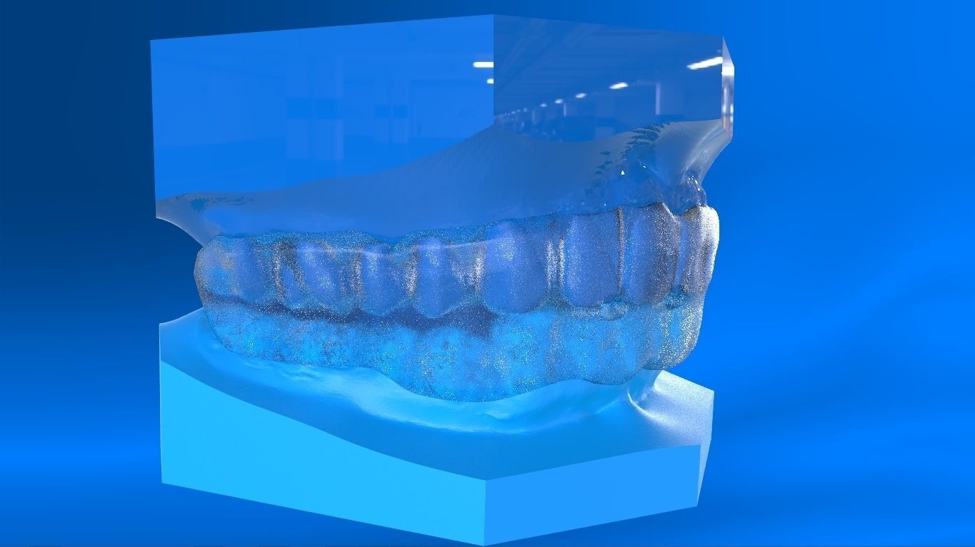Digital Ortho Tooth Positioner 3D model 3D printable | CGTrader