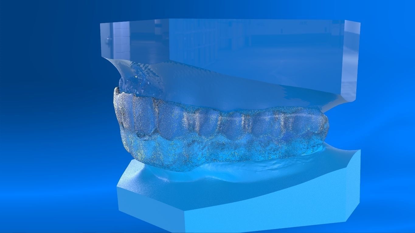 Digital Ortho Tooth Positioner 3D model 3D printable | CGTrader