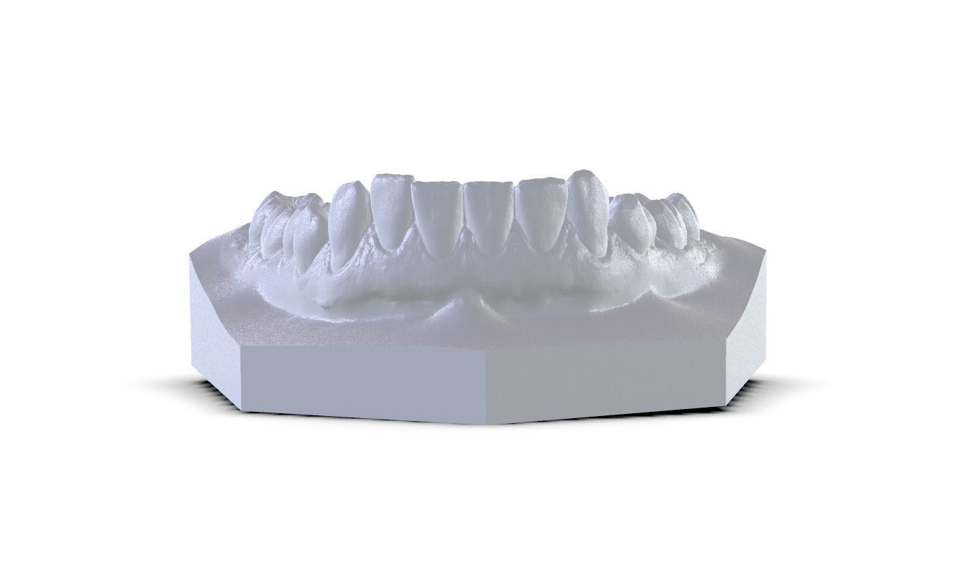 Digital Ortho Tooth Positioner 3D model 3D printable | CGTrader