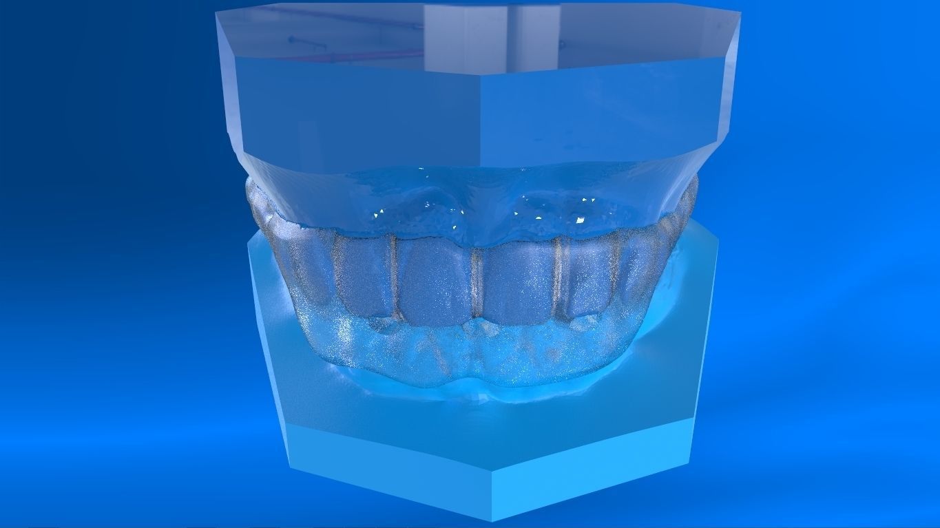 Digital Ortho Tooth Positioner 3D model 3D printable | CGTrader